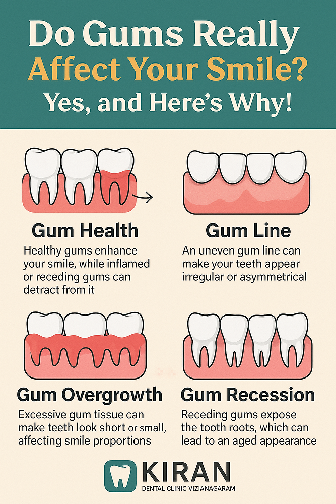 Do Gums Really Affect Your Smile? Yes, and Here's Why!