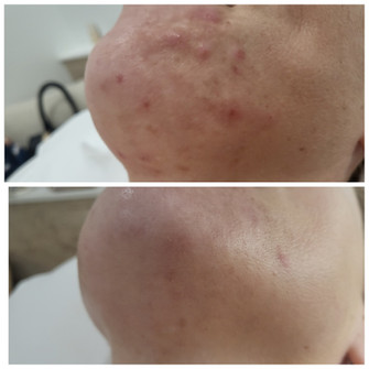 Restoration + Rejuvenation | Jeunesse Skin Health | Skin Care ...