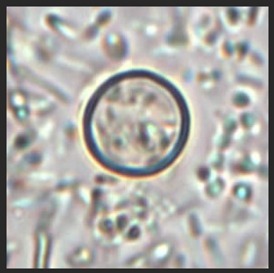 Cyclospora SPP | microbiologiavirtual