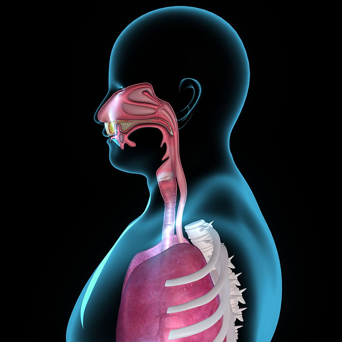 velopharyngeal dysfunction