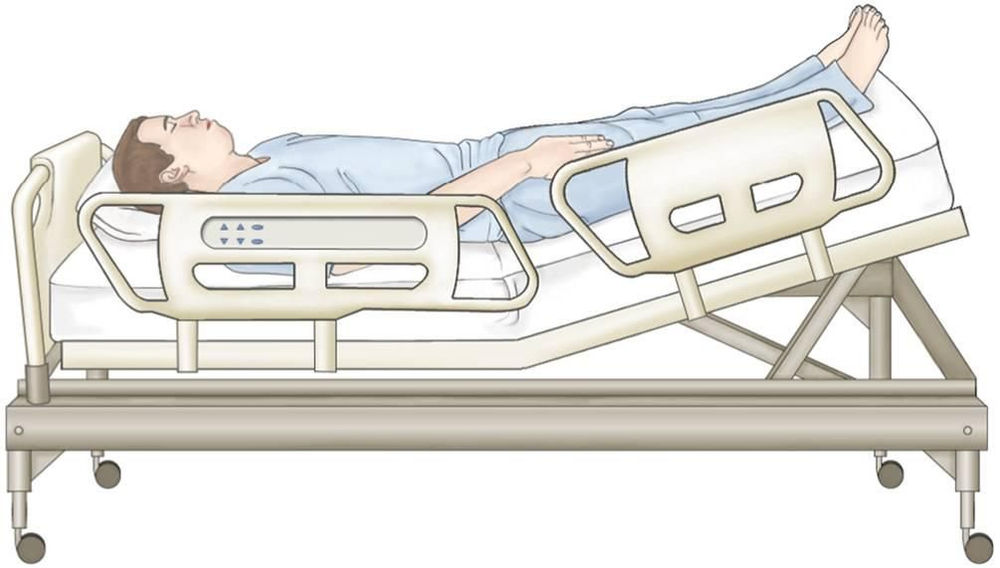 Trendelenburg - Devemos utilizar no manejo da hipotensão