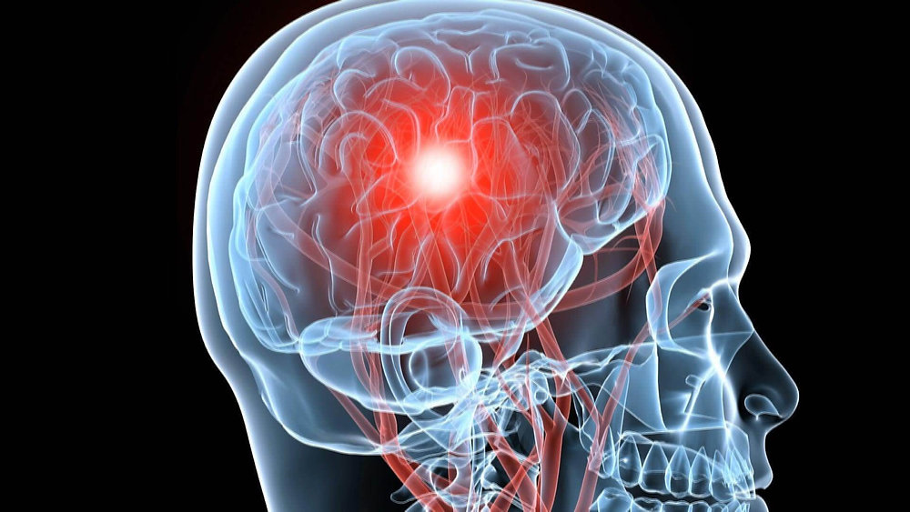 Blunt Force Head Trauma - Common Causes And The Effects It Can Cause