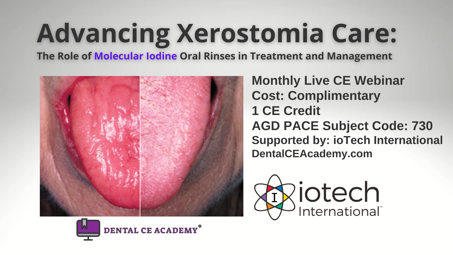Advancing Xerostomia Care | Dental CE Academy