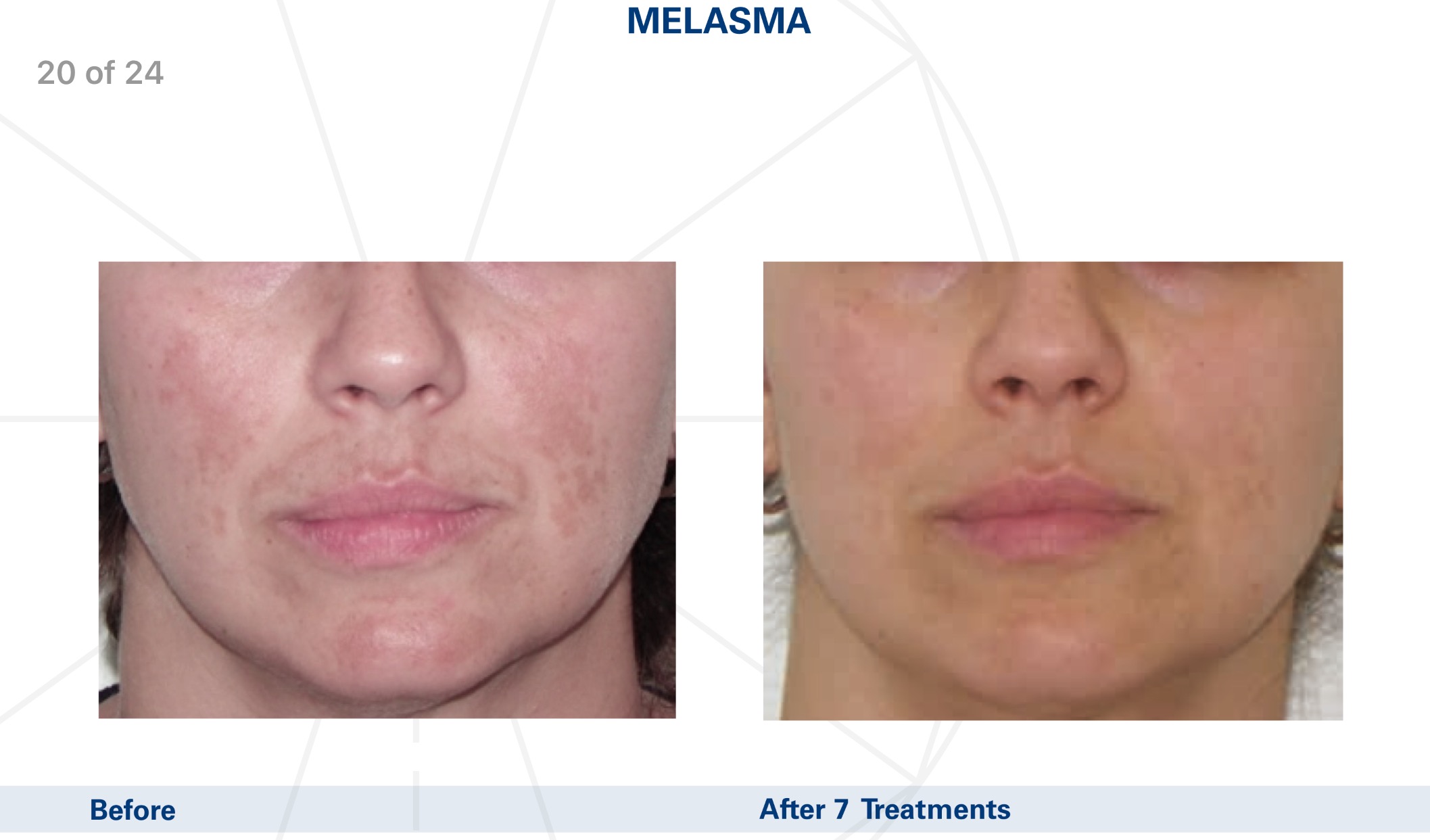 MEDICINA ESTETICA A VERBANIA, Dott Elsharkawy, Trattamenti Macchie