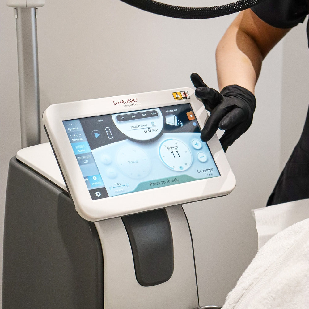 Our Lutronic Ultra "Baby Face" Treatment: Everything You Need to Know