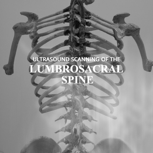 Lumbosacral Spine Scanning Protocol | MUST: Msk Ultrasound