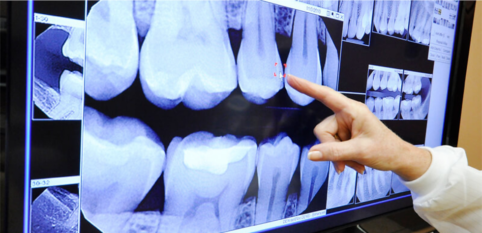 The Evolution of Dental Radiography: From the first X-ray to AI