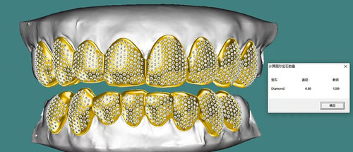 Gold Teeth with Diamond | monde-dental-lab