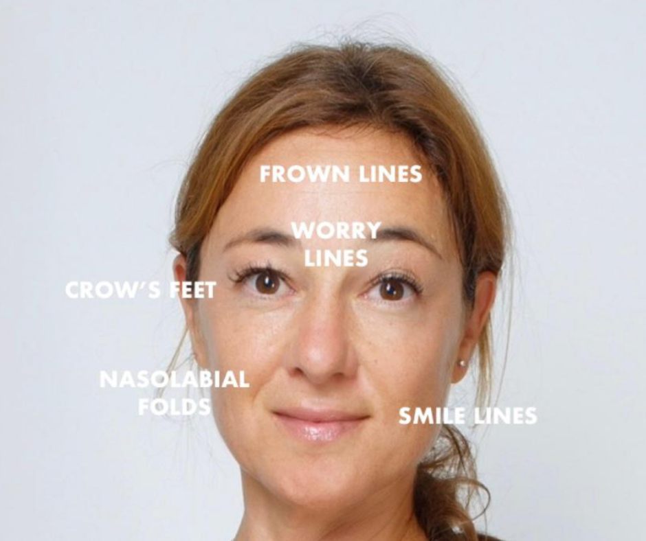 Learn These Exercises to Help Prevent Skin Sagging and Expression Lines