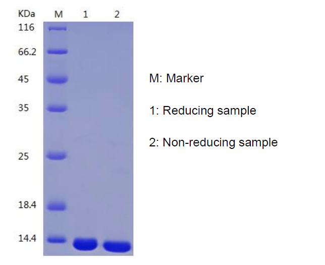 Recombinant Human Beta-2 microglobulin/B2M (C-His) | Bon Opus Biosciences