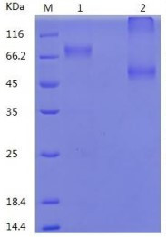 Recombinant Human Megalin/LRP-2 (C4, C-His) | Bon Opus Biosciences