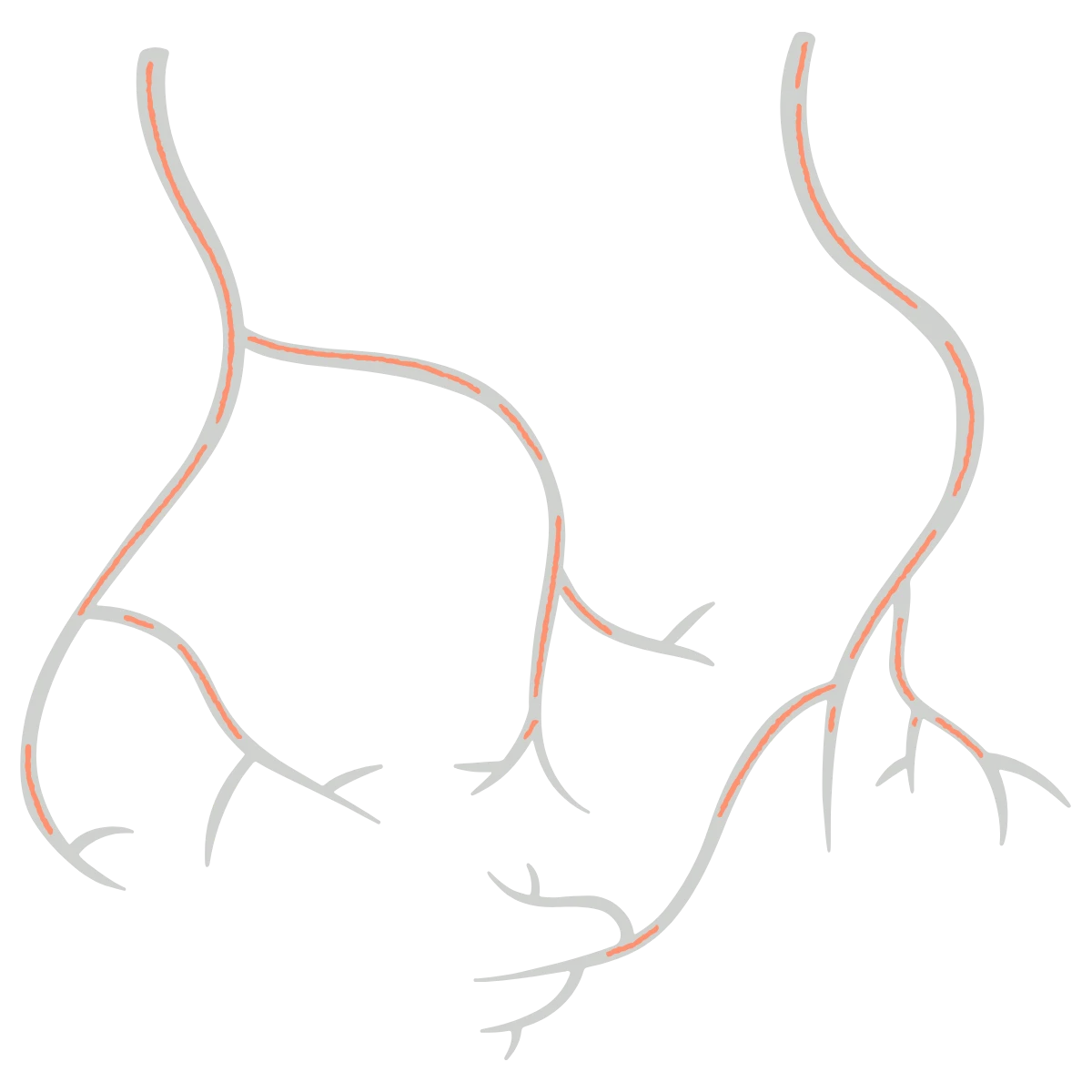 ENFD | Test for small fiber peripheral neuropathy