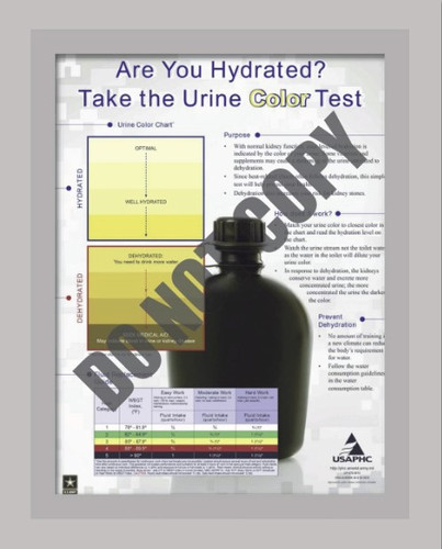 Urine Color Poster | My Site