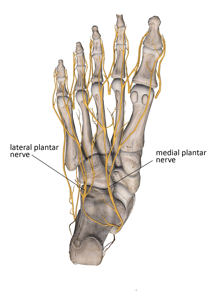 Putting the Squeeze on Morton’s Neuroma
