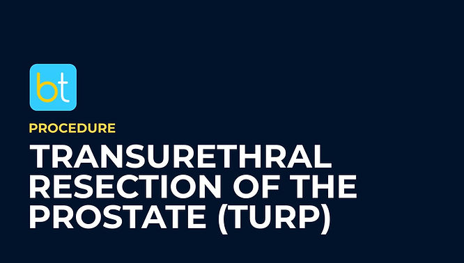Transurethral Resection of the Prostate (TURP) Procedure Prep ...