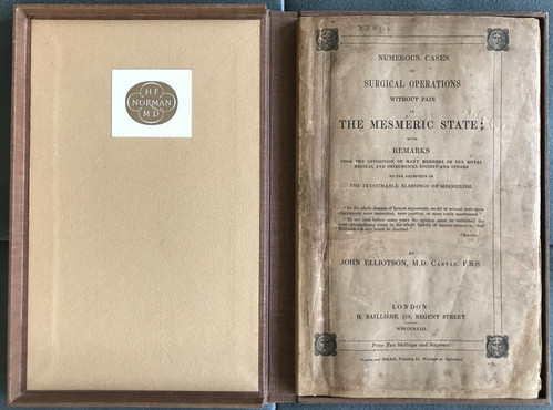 Elliotson, Surgical Operations in the Mesmeric State, Presentation ...