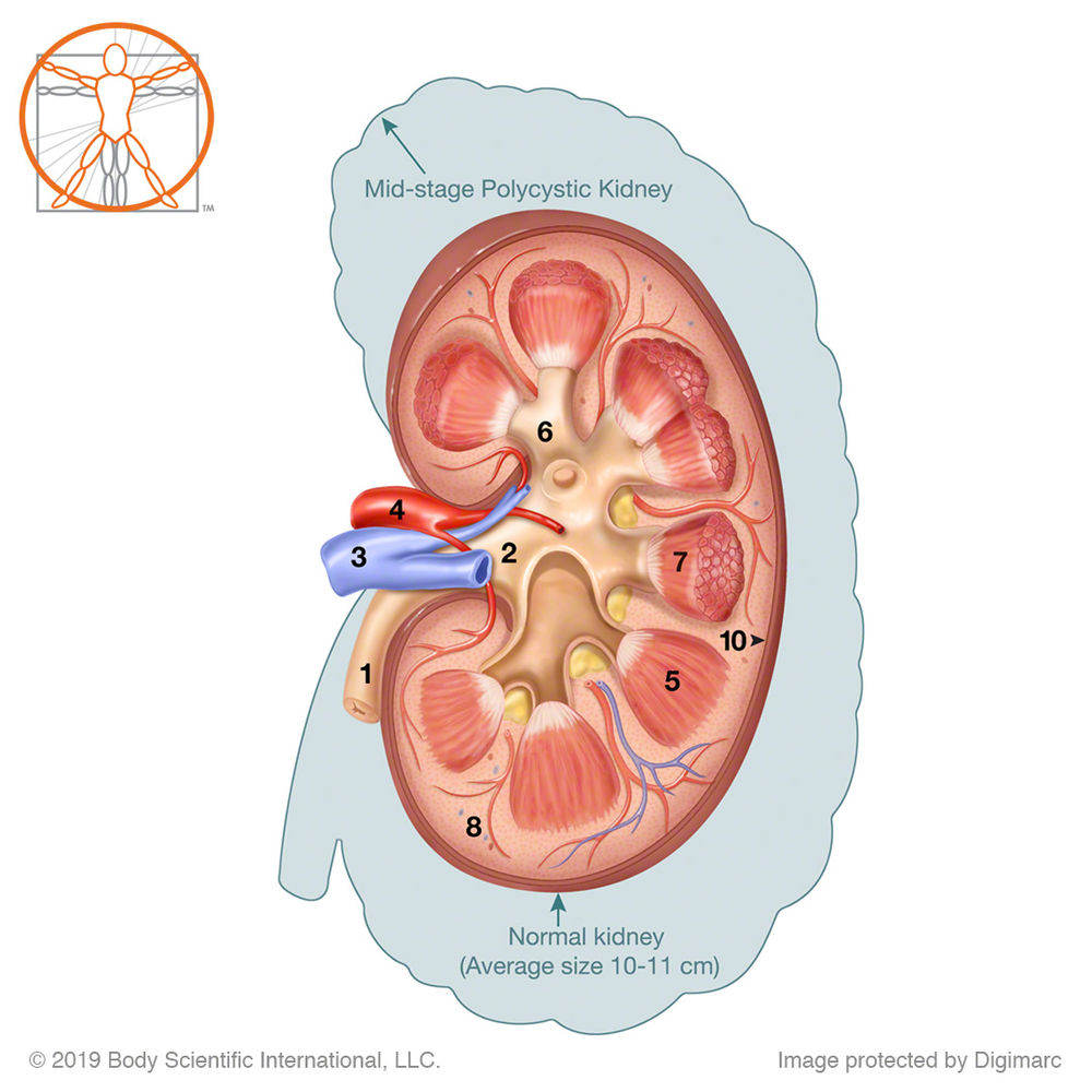 Polycystic Kidney Model : From Concept to Production
