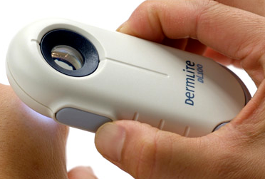 DermLite DL 100 | skintech