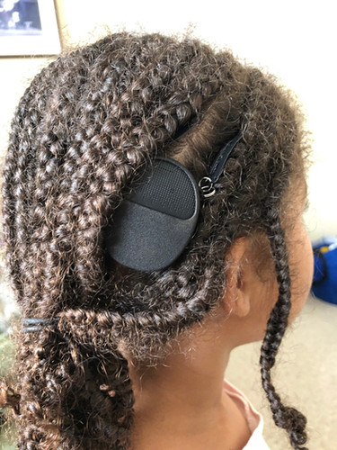 Rondo 3 | CI Retention Solutions