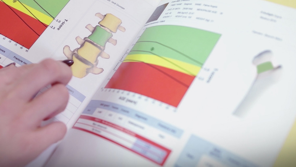Precision Bone Imaging | REMS Osteoporosis Scan
