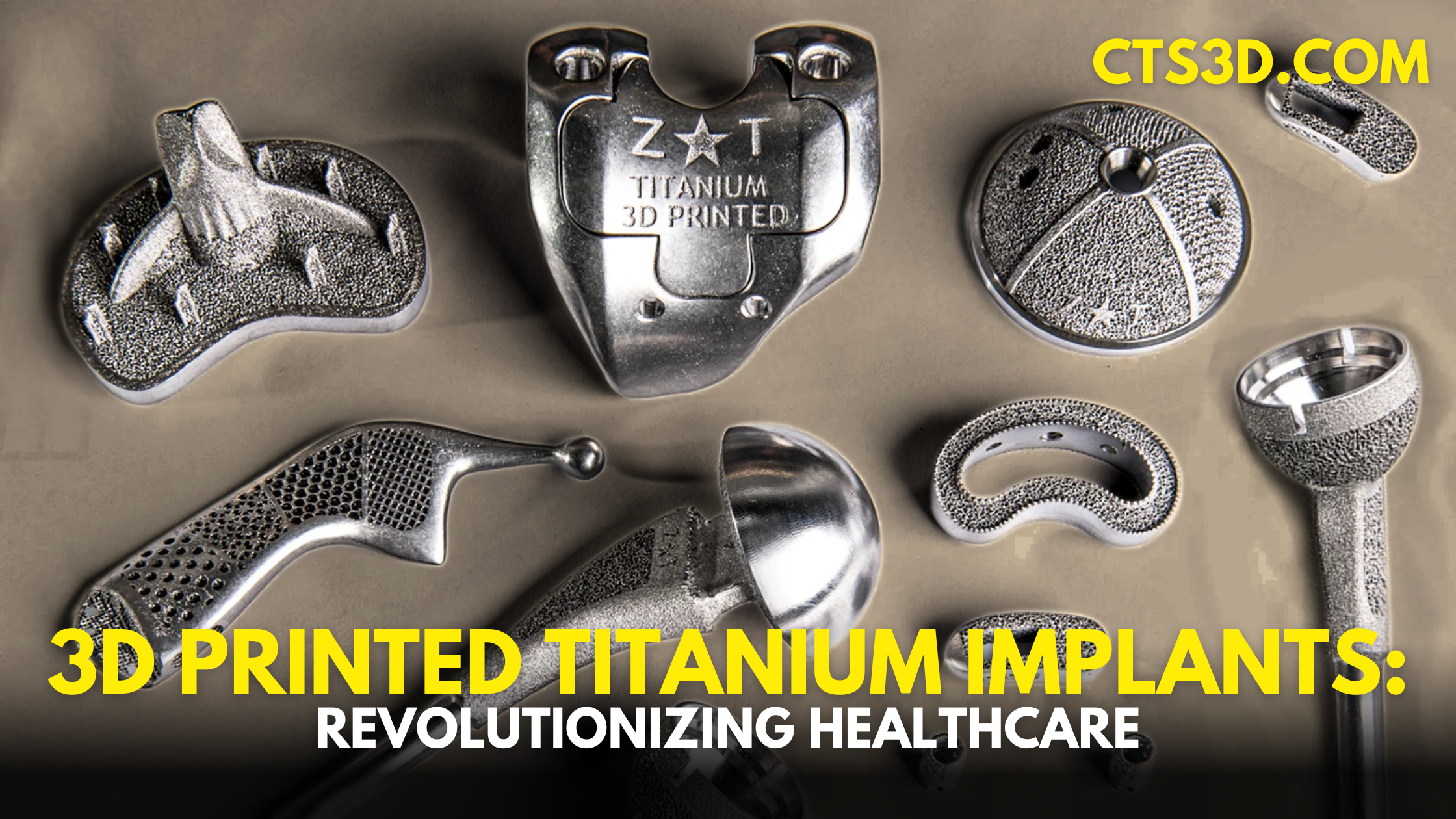 3D Printed Titanium Implants: Revolutionizing Healthcare