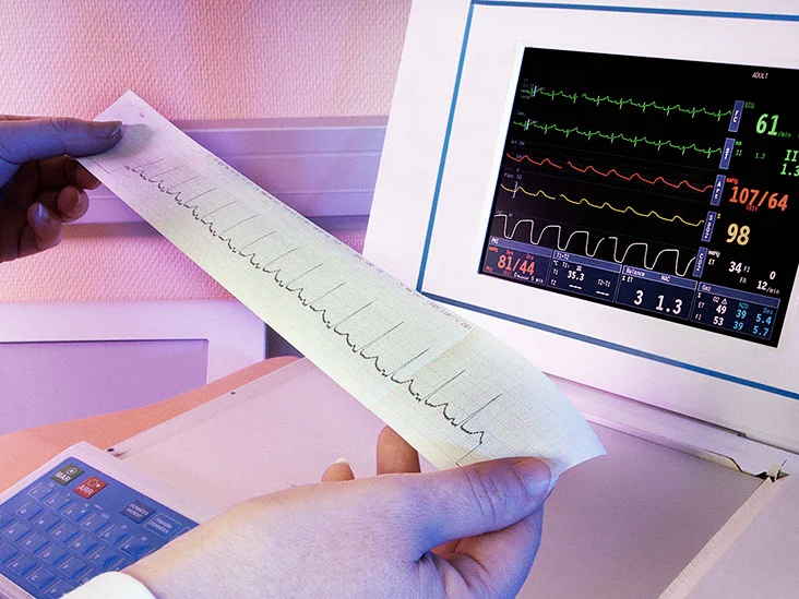 Elettrocardiogramma. Infermieri: come si fa.