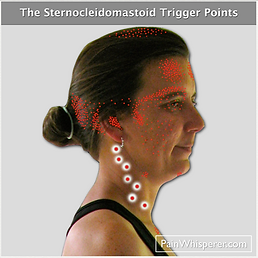 head temples headache