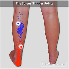 PainWhisperer.com | Trigger Point Therapy for Calf, Ankle, Foot Pain