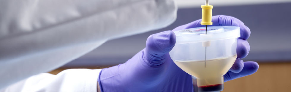 BMAC SmartPrep 3 | Products | MDBiologix