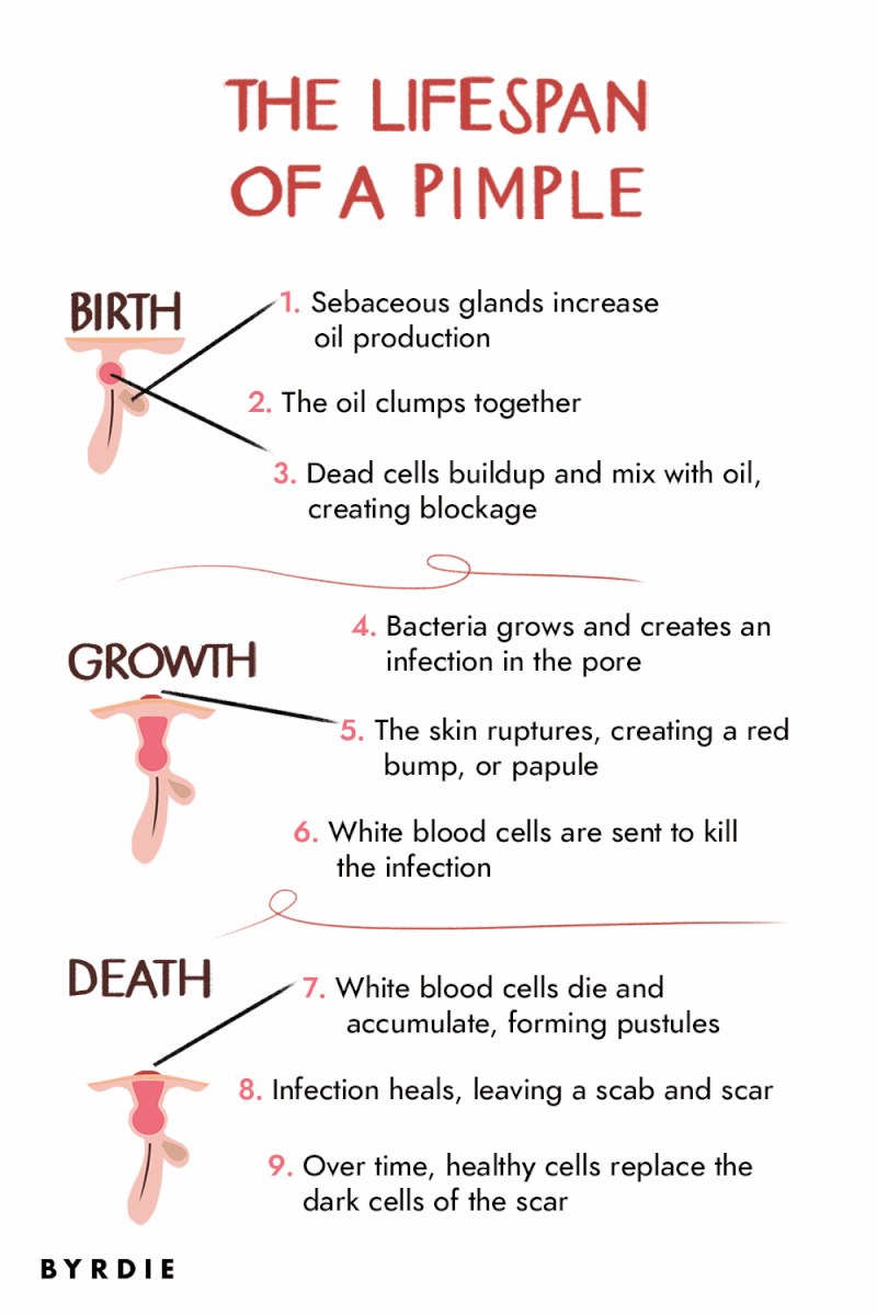 Acne Positivity versus Social Stigma