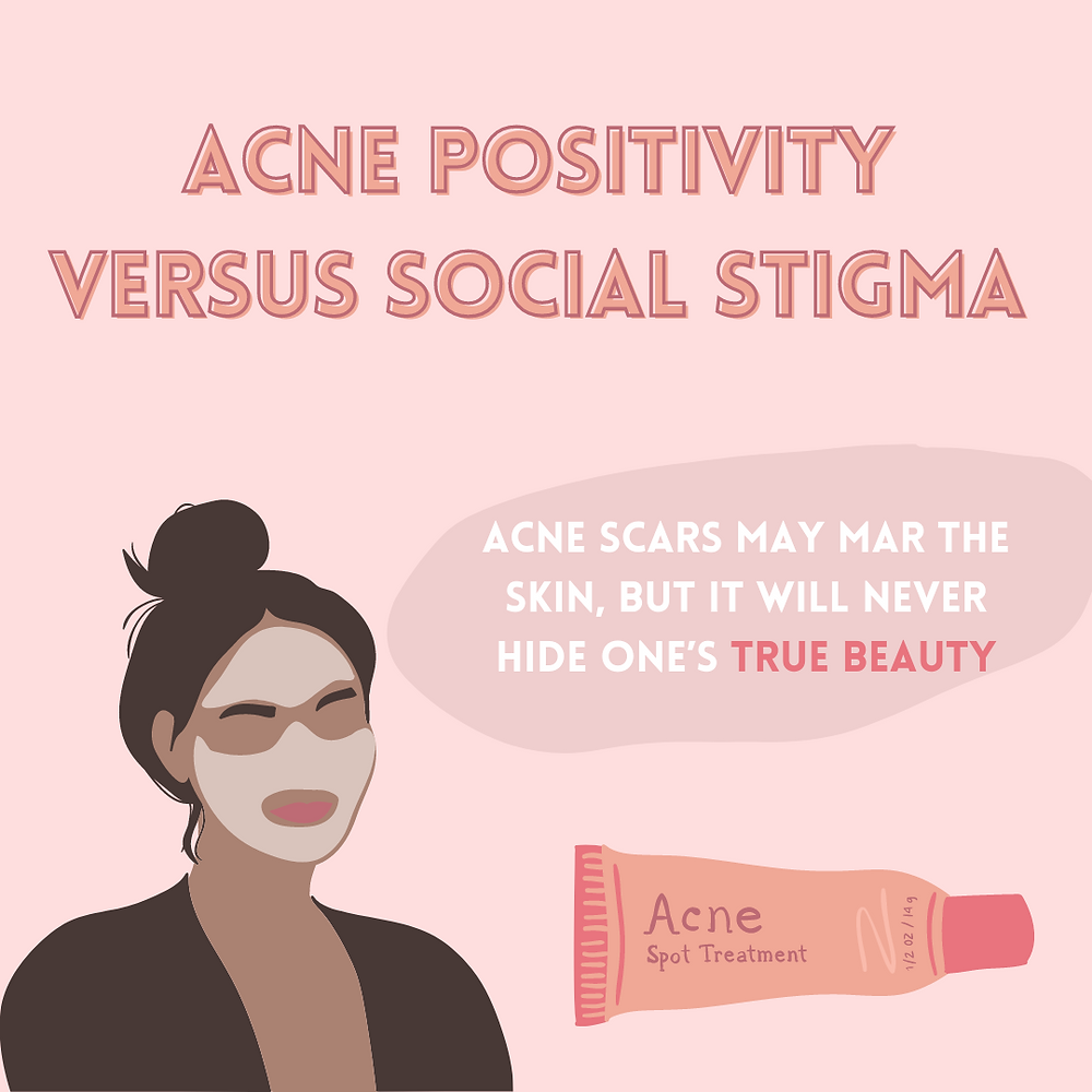 Acne Positivity versus Social Stigma