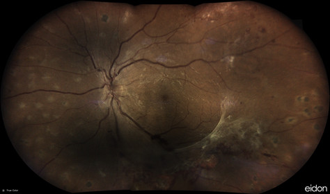 Retinal Imaging | Pacific Optometry Group