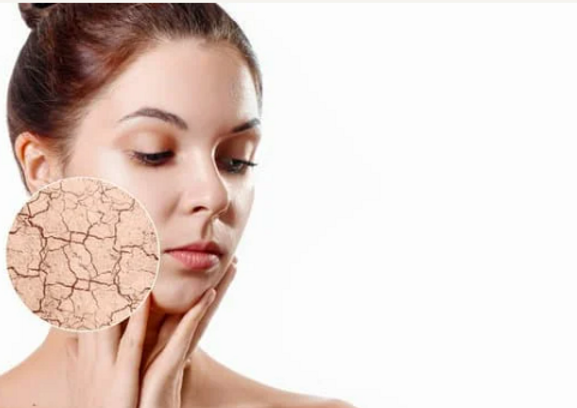 Dry Skin: Types, Risk Factors, and Treatments