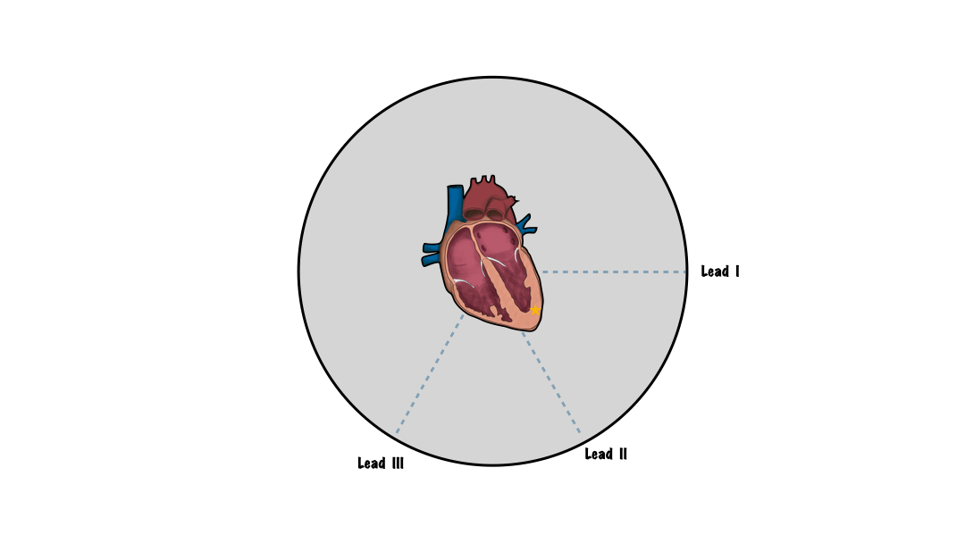 Home E|X|G - ECG Interpretation Bootcamp