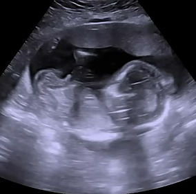 Bloom Ultrasound & Pregnancy Spa | Ultrasounds in Austin | 2525 ...