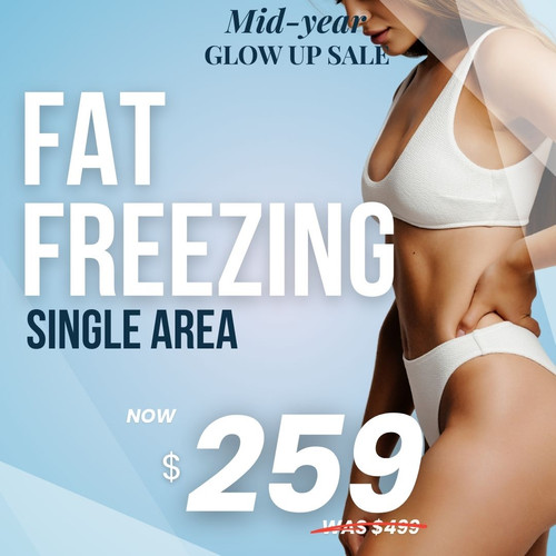 Fat Freezing Special $339 for beginner | MY BODY VIBES