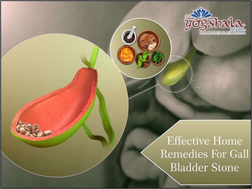 EFFECTIVE HOME REMEDIES FOR GALL BLADDER STONE