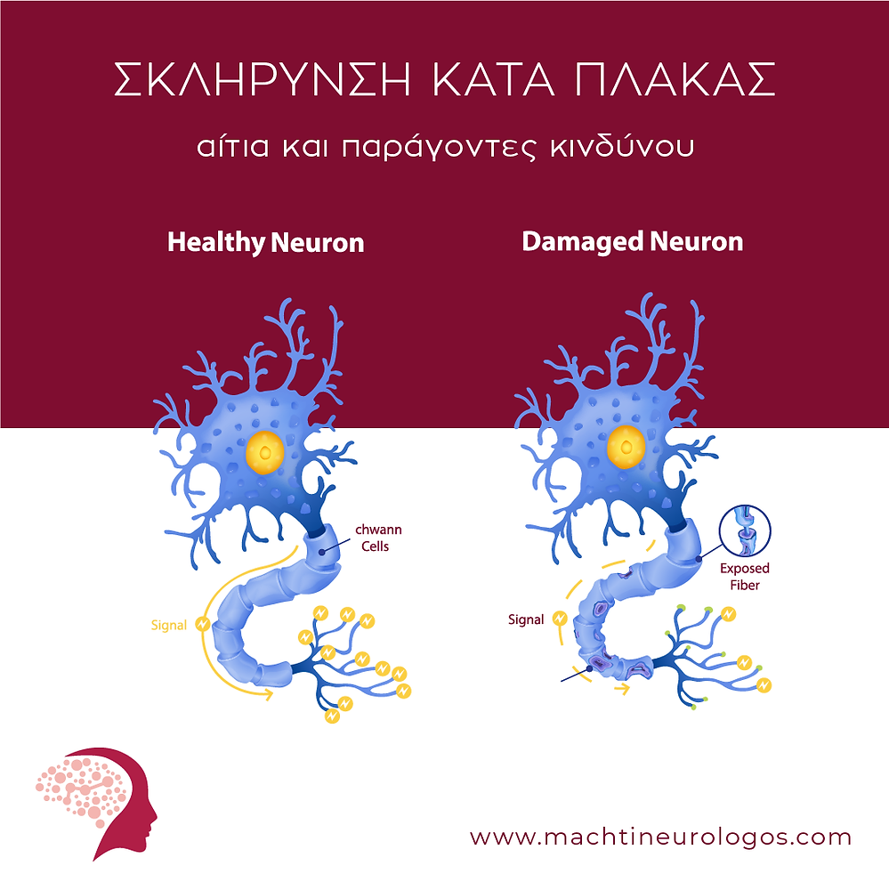 Σκλήρυνση κατά πλάκας Μέρος Β΄
