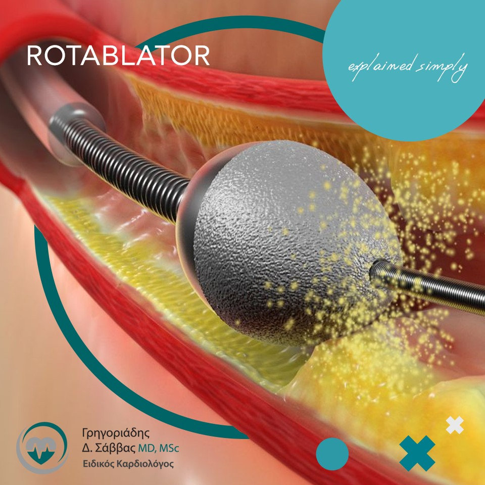 Rotablator – τι είναι;