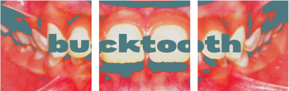 BUCKTOOTH | 'Anti-brand' Fashion