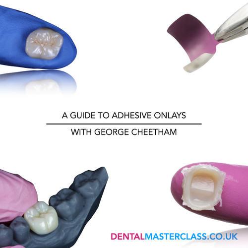 George Cheetham- E.max Onlay Preparation | dentalmasterclass
