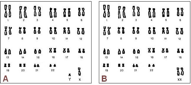 Caryotype Homme femme | svtaubrac