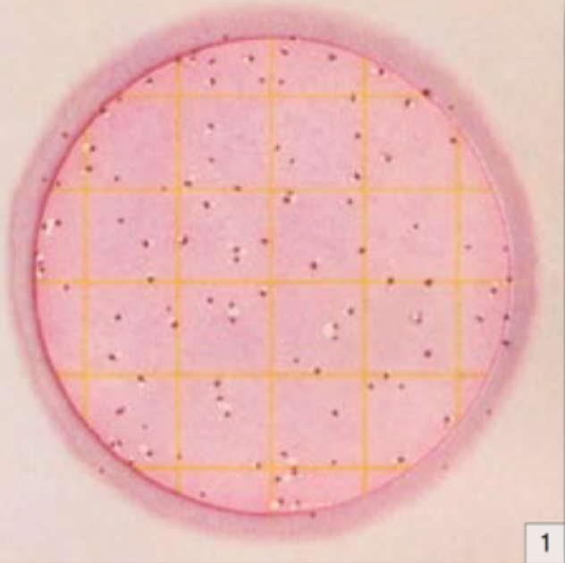 Microrganismos indicadores: coliformes