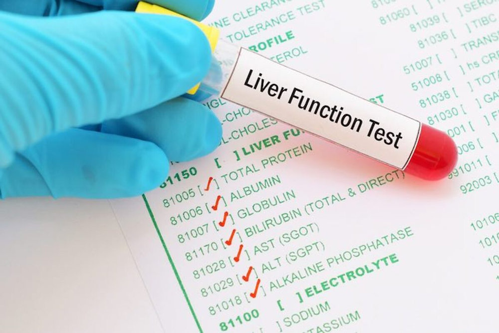 All You Need To Know About Liver Function Test all-you-need-to-know-about-liver-function-test