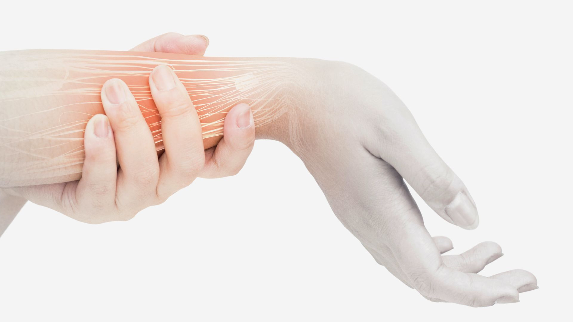 Síndrome Compartimental del Antebrazo: una Complicación Posterior a una ...