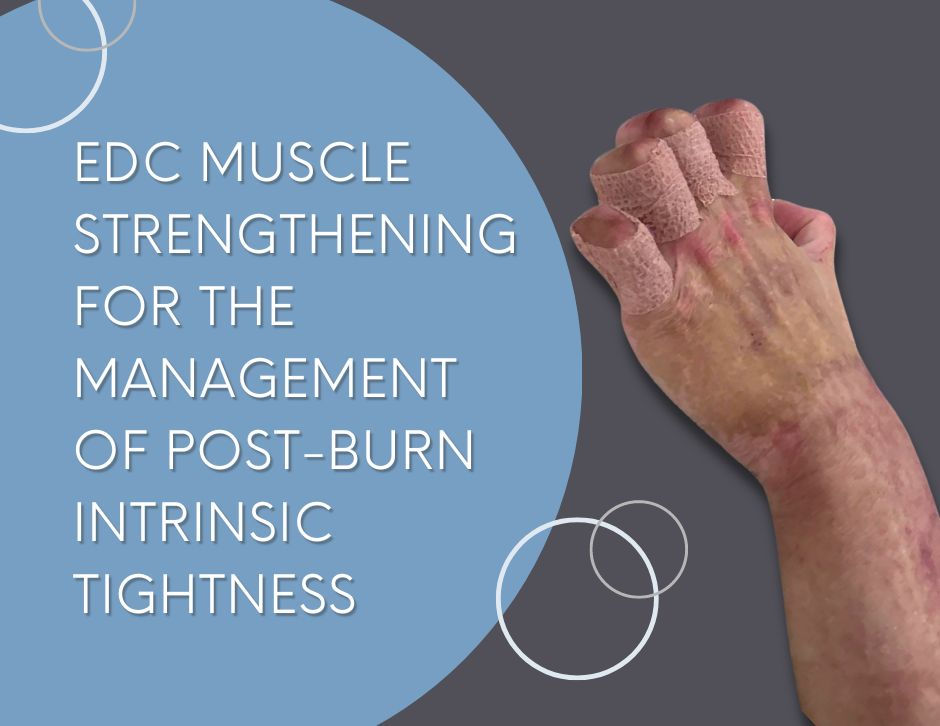 EDC muscle strengthening exercise for post-burn intrinsic tightness ...
