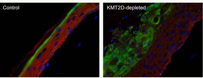 Highly mutated cancer gene, KMT2D, coordinates skin tissue renewal