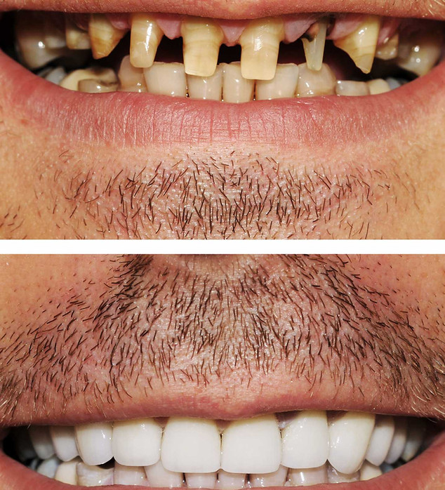 nhs crown coloring pages