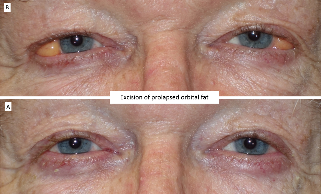 Services | Pacific Oculofacial Plastic Surgery | United States