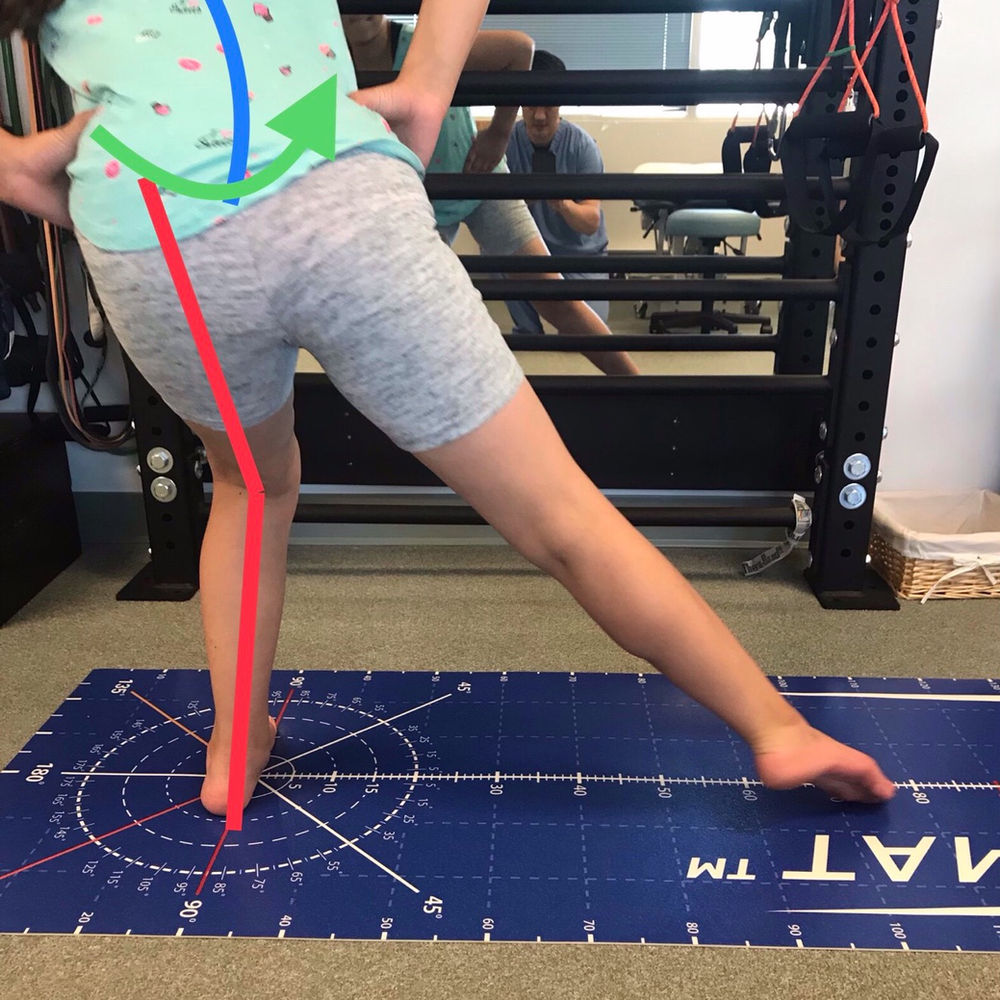 Do You Need Help with Child with Hypermobility Syndrome to Improve Leg ...